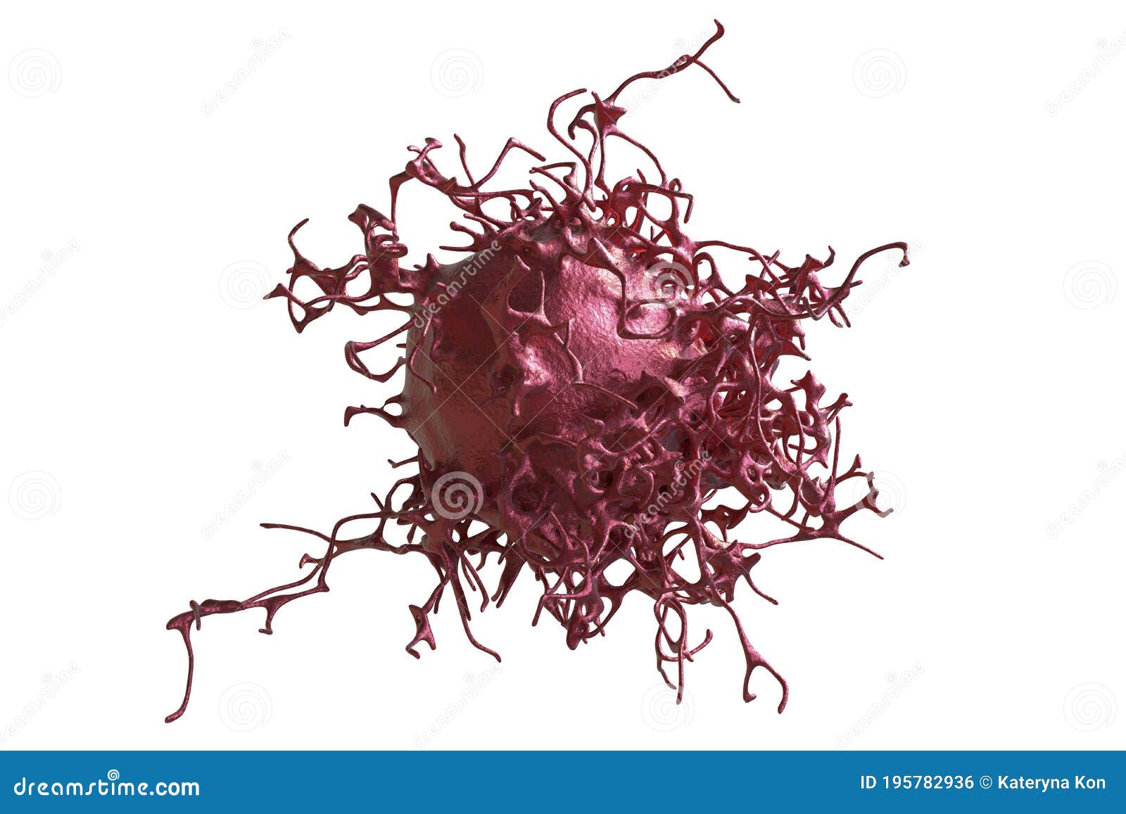 Cervical Cancer Cells Stock Illustration Illustration Of Pathology