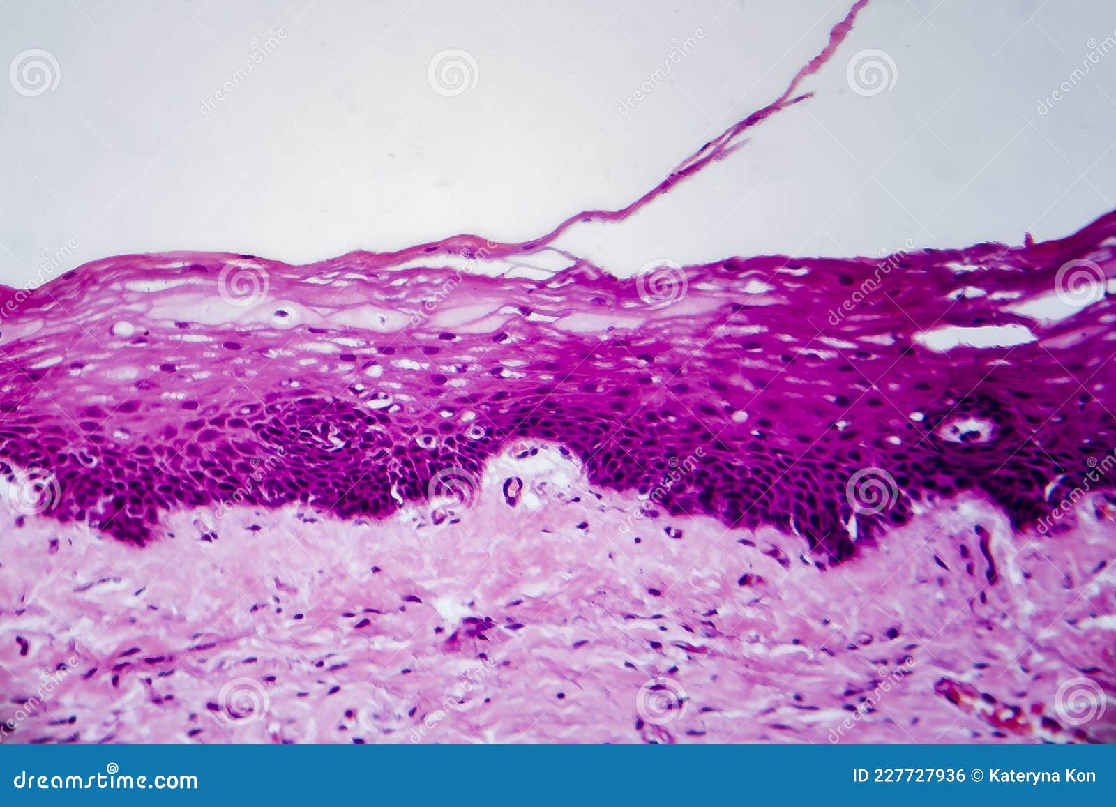Skin Erosion Histology