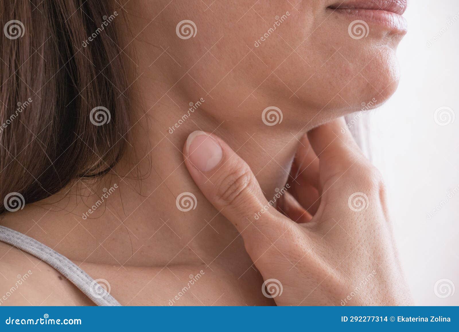 Cervical Lymphadenitis of the Right Side in a Woman. Stock Photo ...