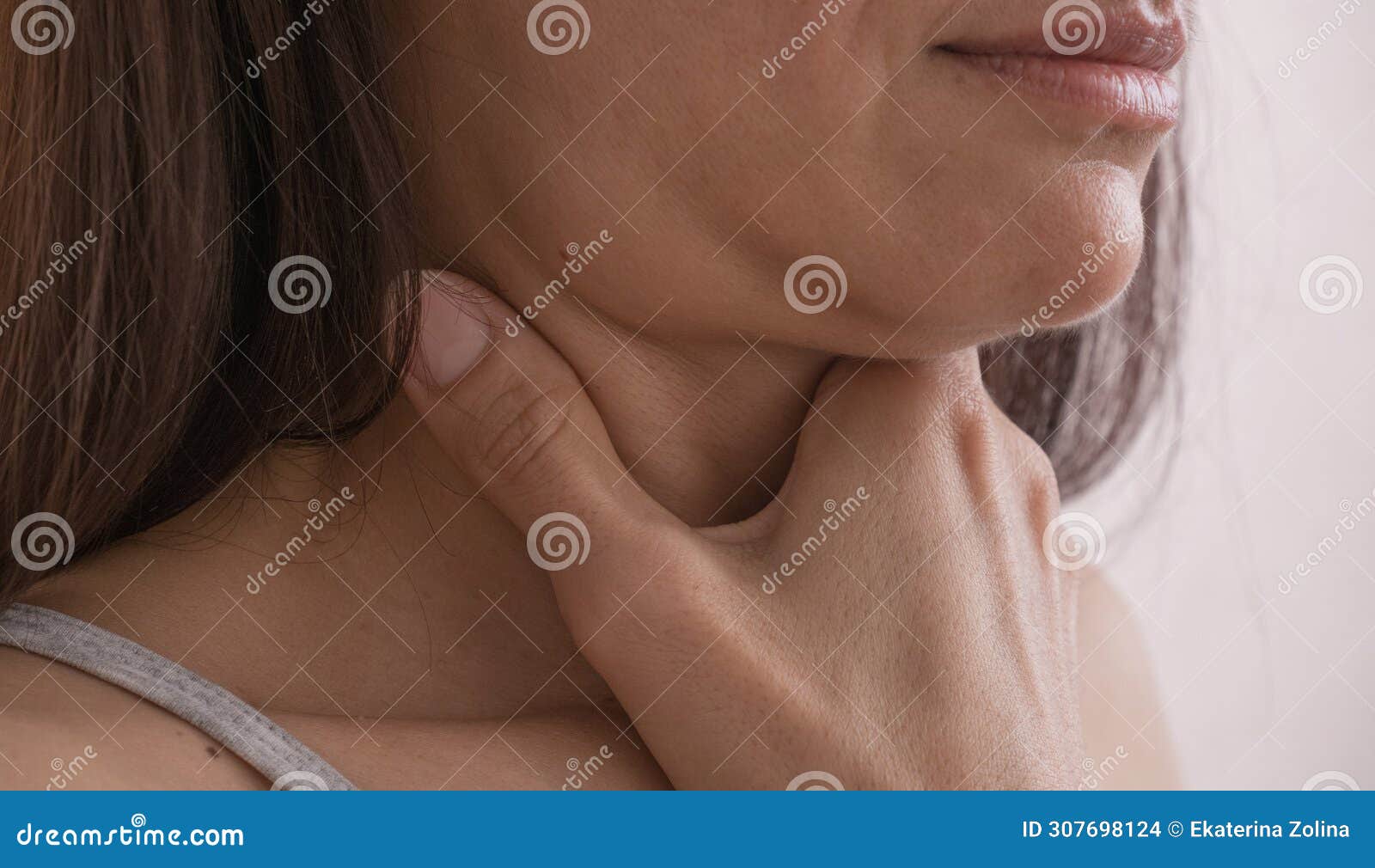 Cervical Lymphadenitis of the Right Side in a Woman. Stock Photo ...