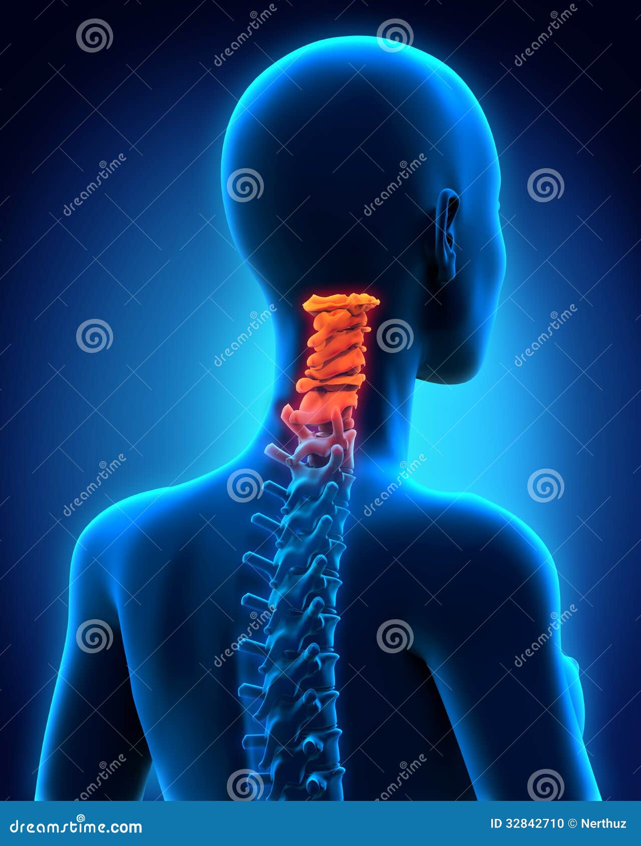 Cervical Spine Anatomy stock illustration. Illustration of painful ...