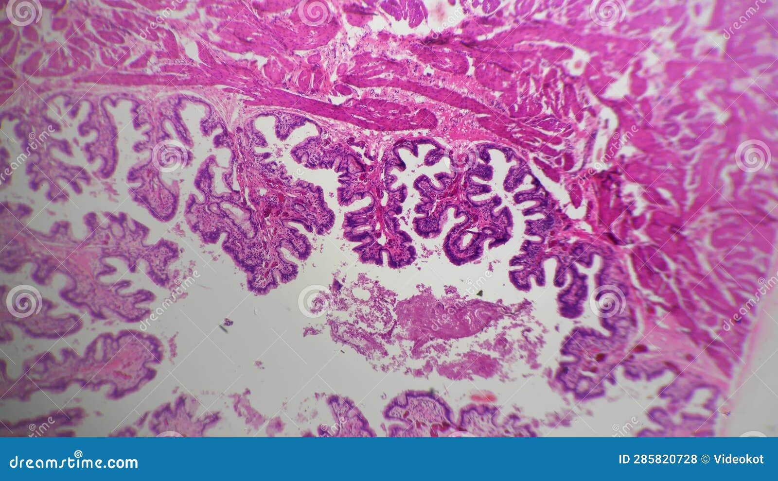 Cervix in Section Filmed Under Light Micrograph with 40 Times ...