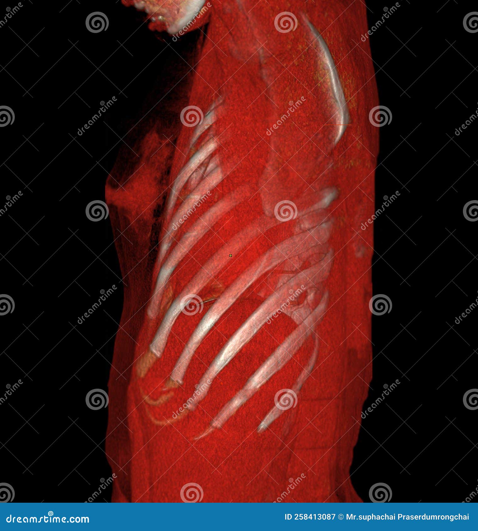 Ch Brustkorb 3d Das Eine Realistische Brustkorbbildung Anatomisch Korrekt Macht Stock Abbildung