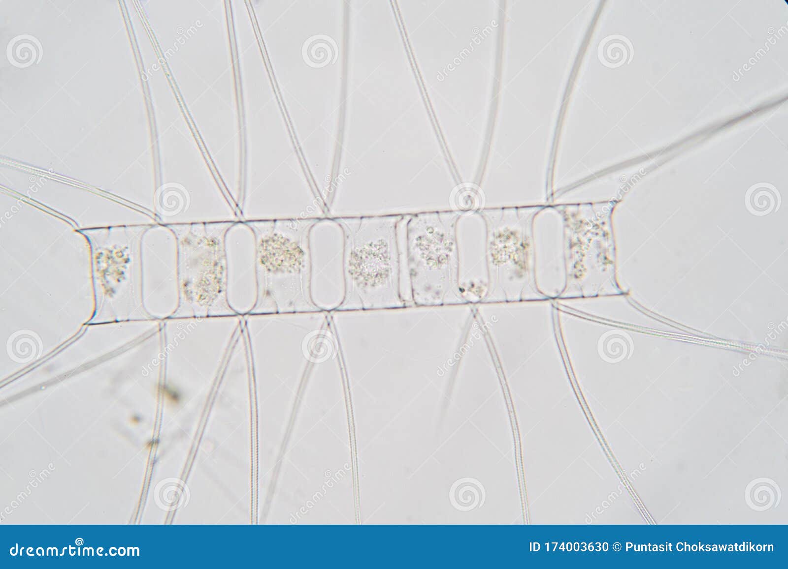 Chaetoceros is Marine Planktonic Diatoms Under Microscope View Stock ...