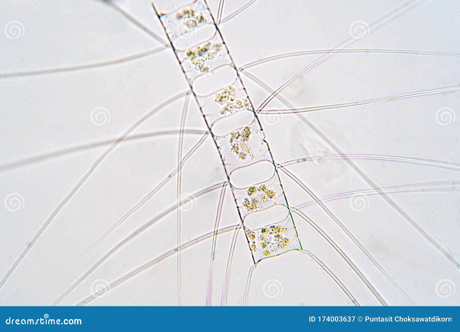 Chaetoceros Is The Largest Genus Of Marine Planktonic Diatoms Stock ...