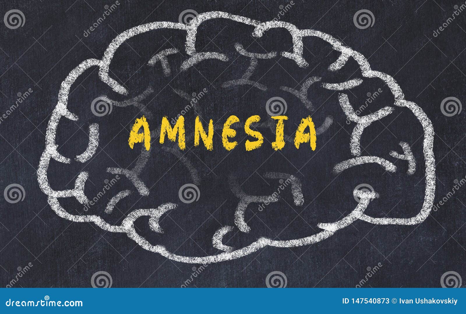 Chalk Drawing of Human Brain with Inscription Amnesia Stock Image ...