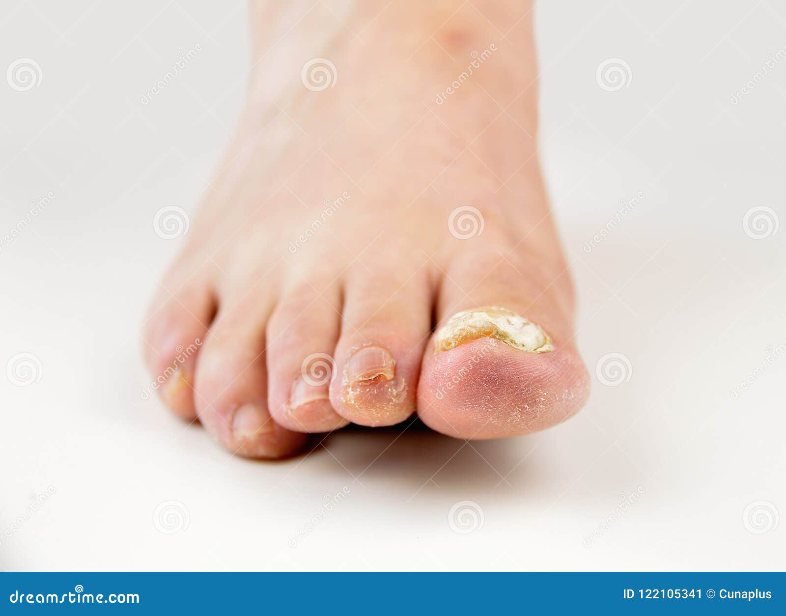 Champignon De Clou Dans Le Blanc Image stock - Image du fuselage ...