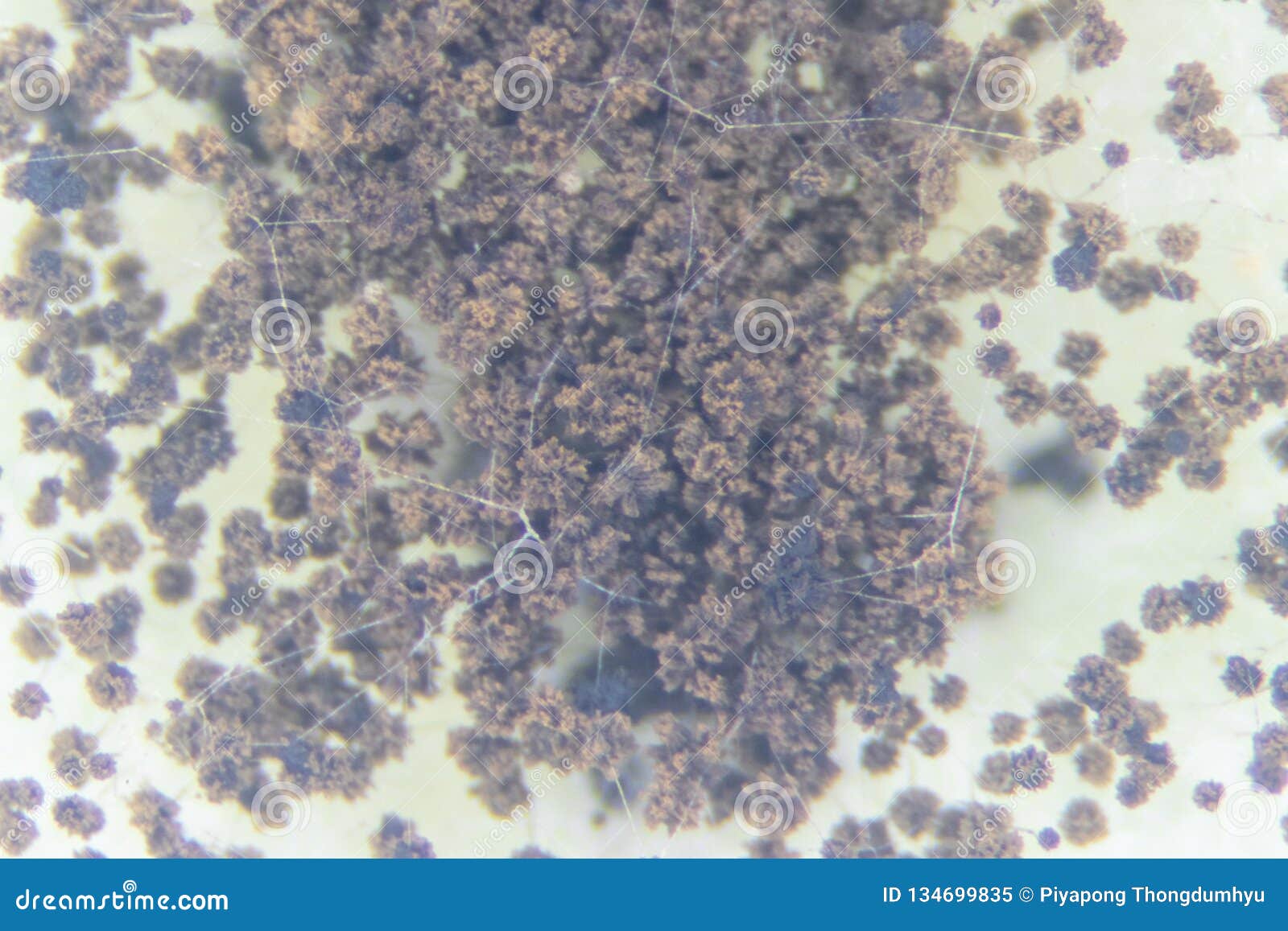 Champignons, Moule De Pain De Rhizopus Sous Le Microscope Image stock ...