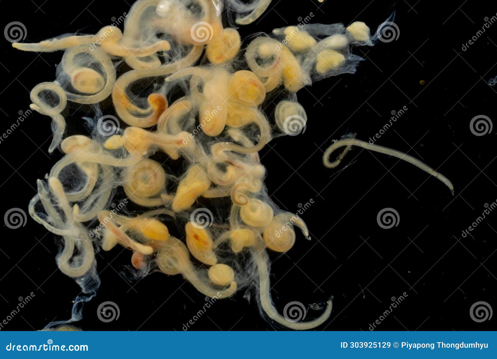 Thorny-headed Worms, or Spiny-headed Worms and Ascaris Under the ...