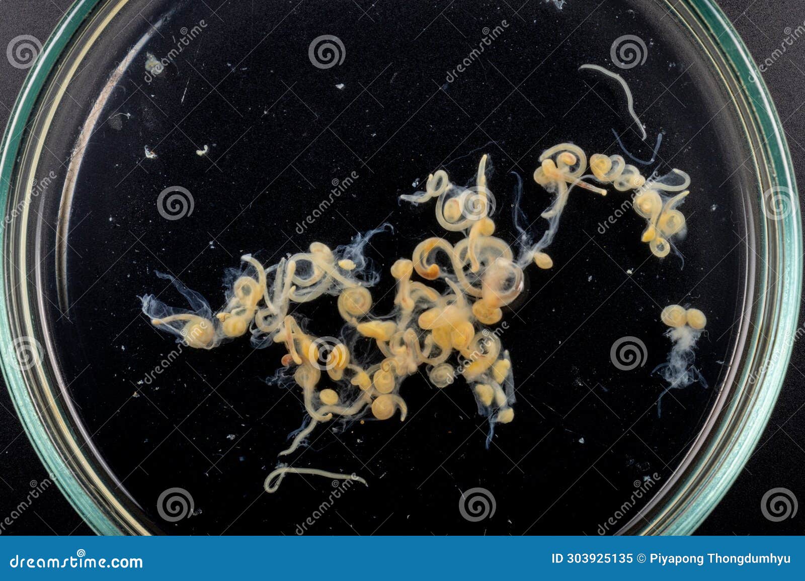 Thorny-headed Worms, or Spiny-headed Worms and Ascaris Under the ...