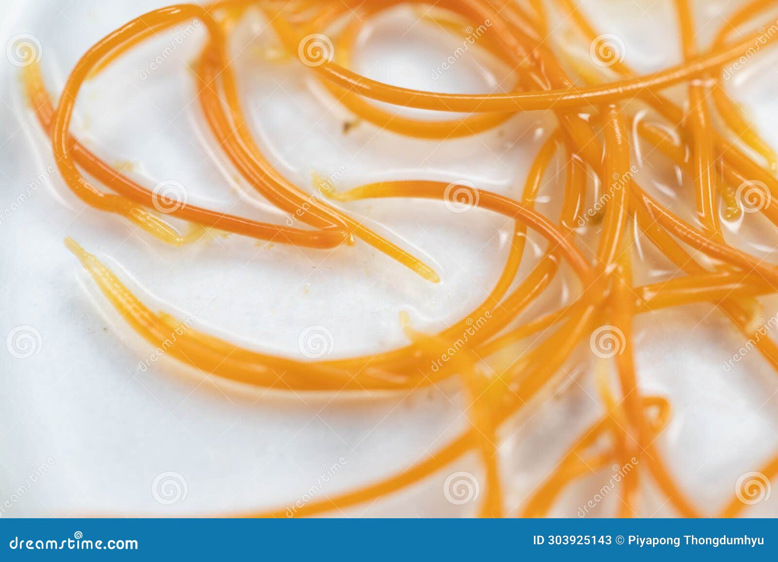 Thorny-headed Worms, or Spiny-headed Worms and Ascaris Under the ...