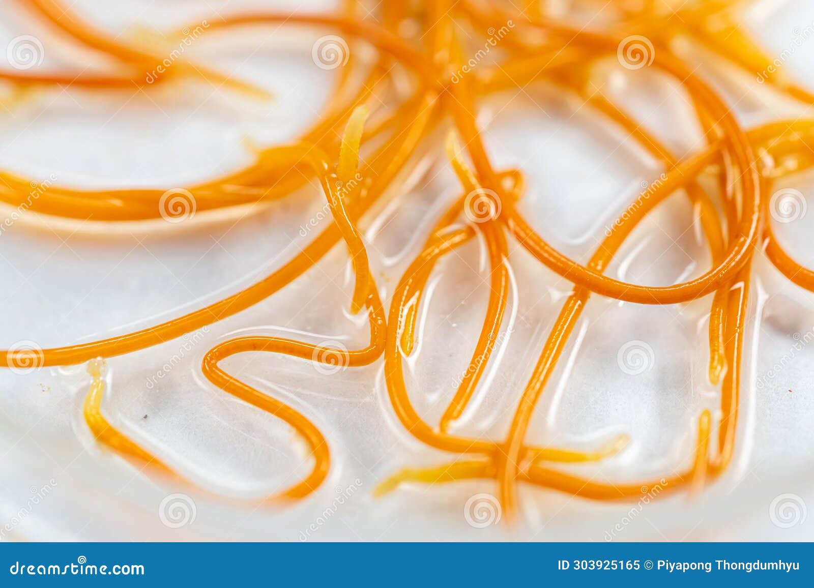 Thorny-headed Worms, or Spiny-headed Worms and Ascaris Under the ...