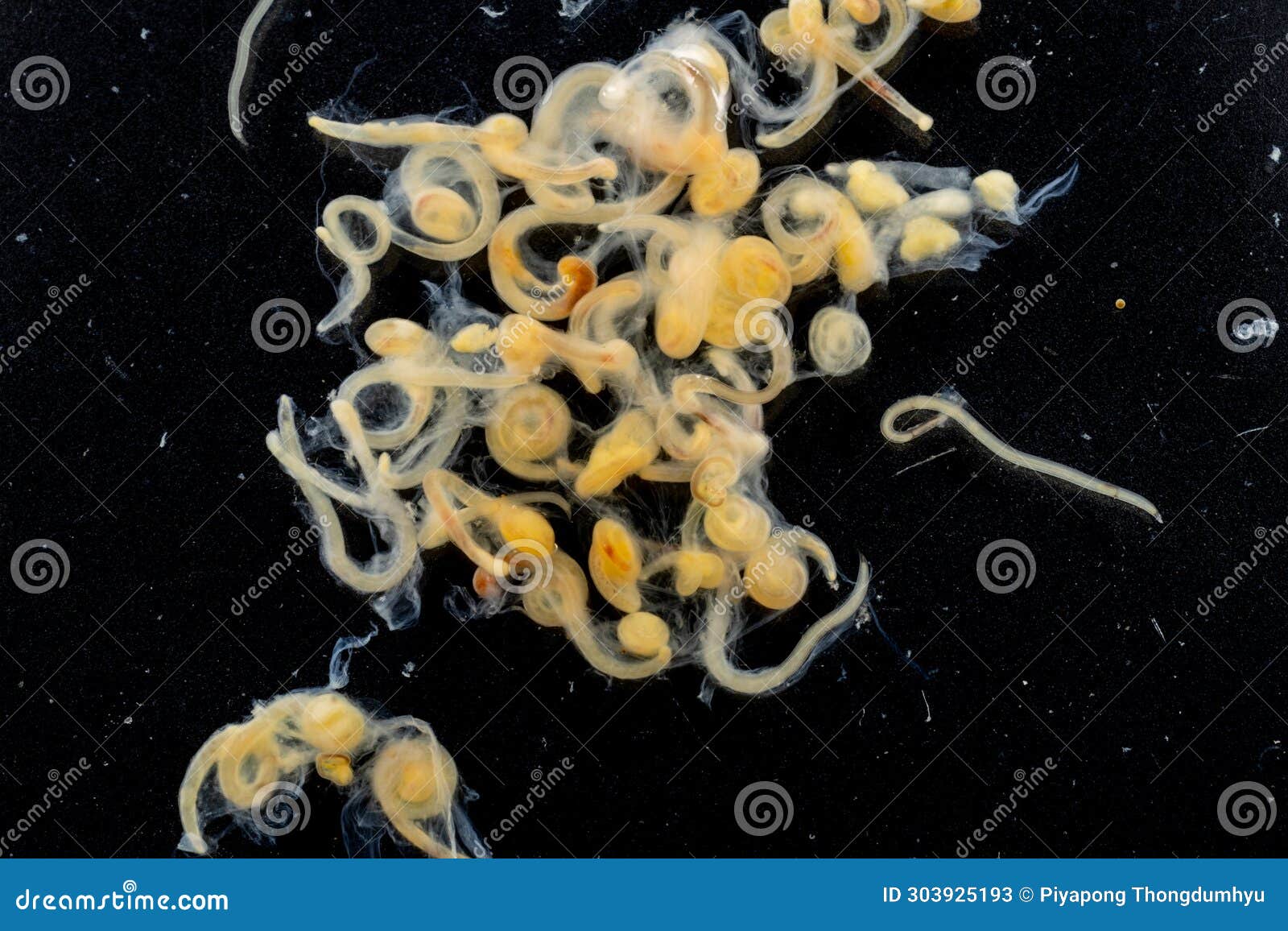 Thorny-headed Worms, or Spiny-headed Worms and Ascaris Under the ...