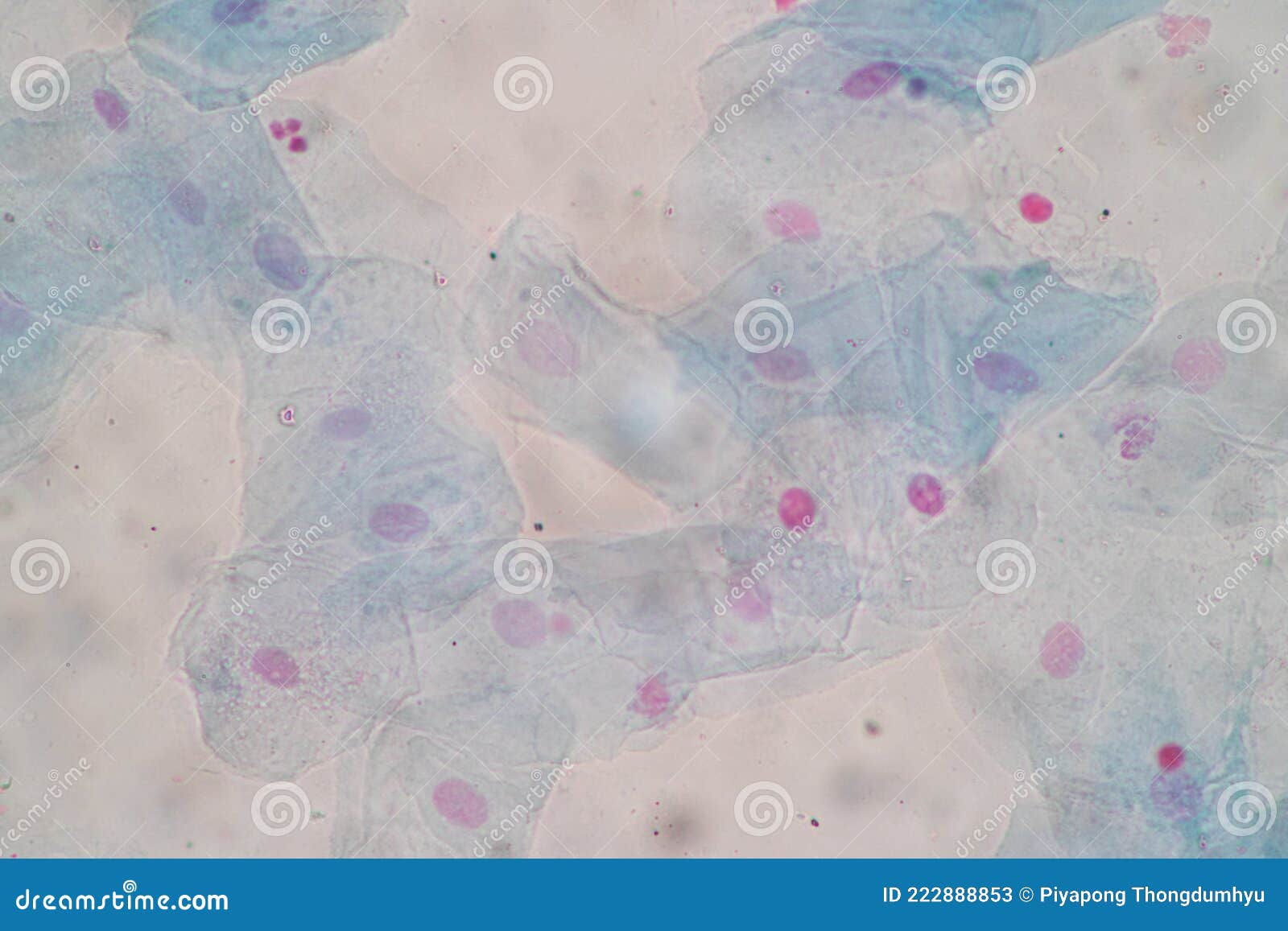 Histological Sample Squamous Epithelial Cells Under Microscope. Stock ...