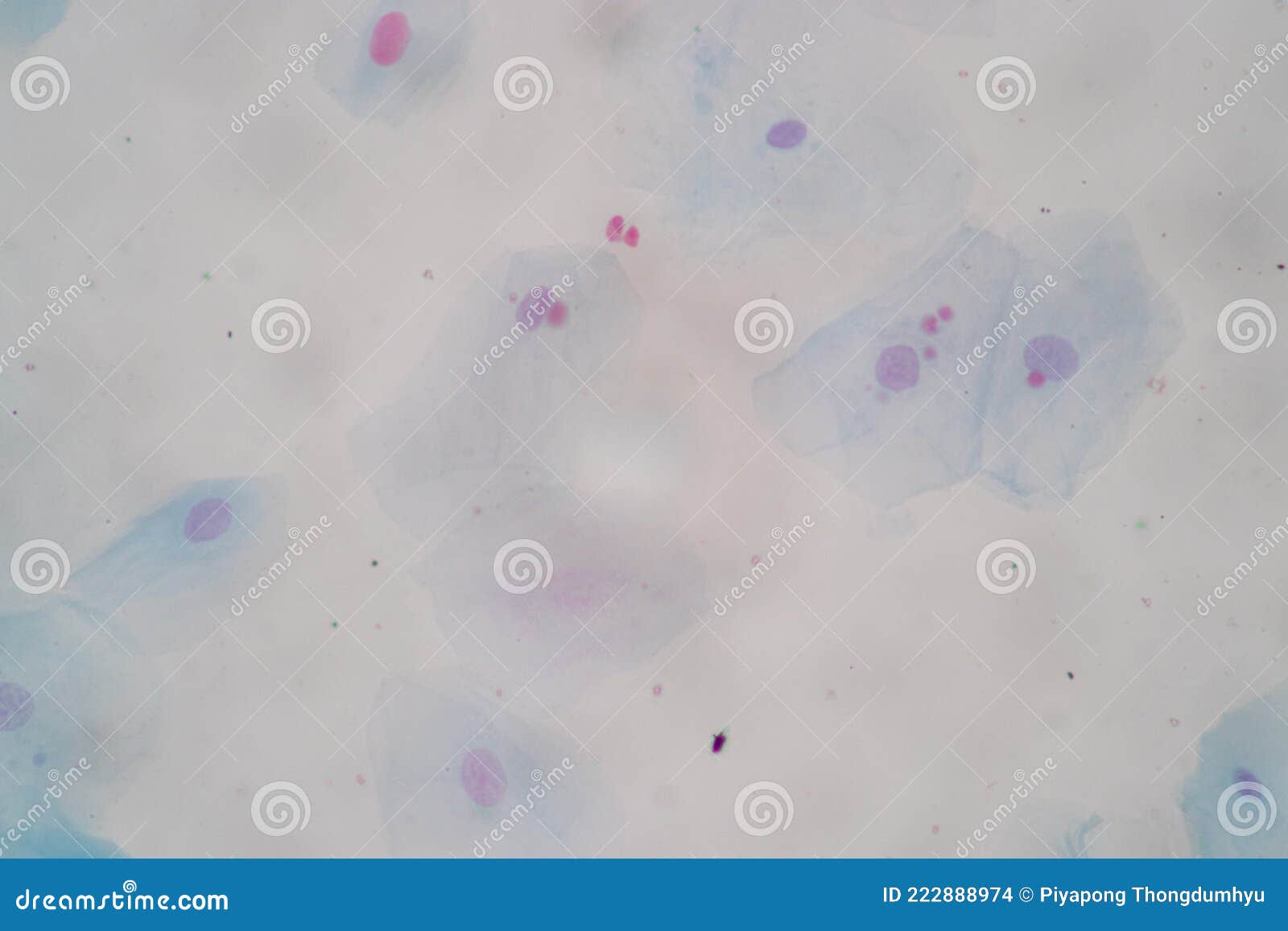 Histological Sample Squamous Epithelial Cells Under Microscope. Stock ...