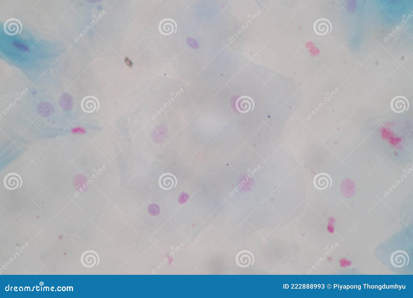 Histological Sample Squamous Epithelial Cells Under Microscope. Stock ...
