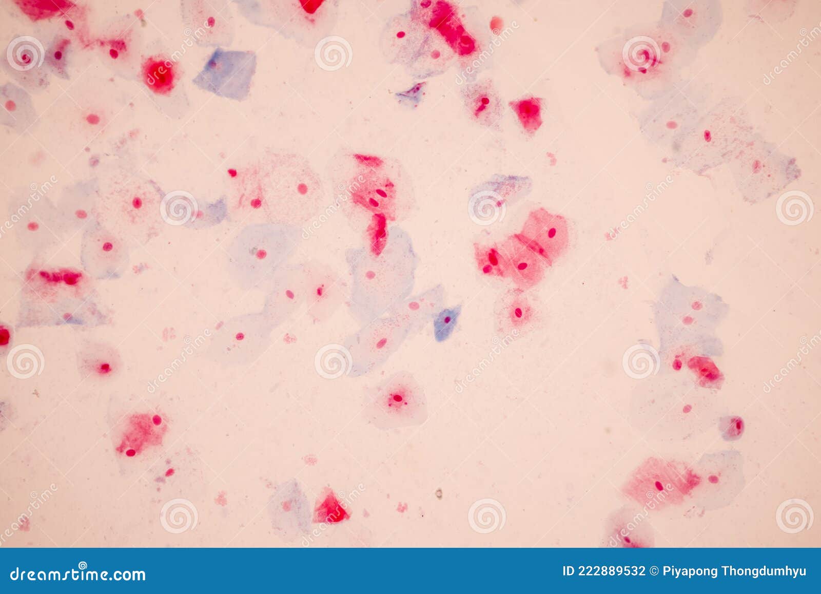 Histological Sample Squamous Epithelial Cells Under Microscope. Stock ...