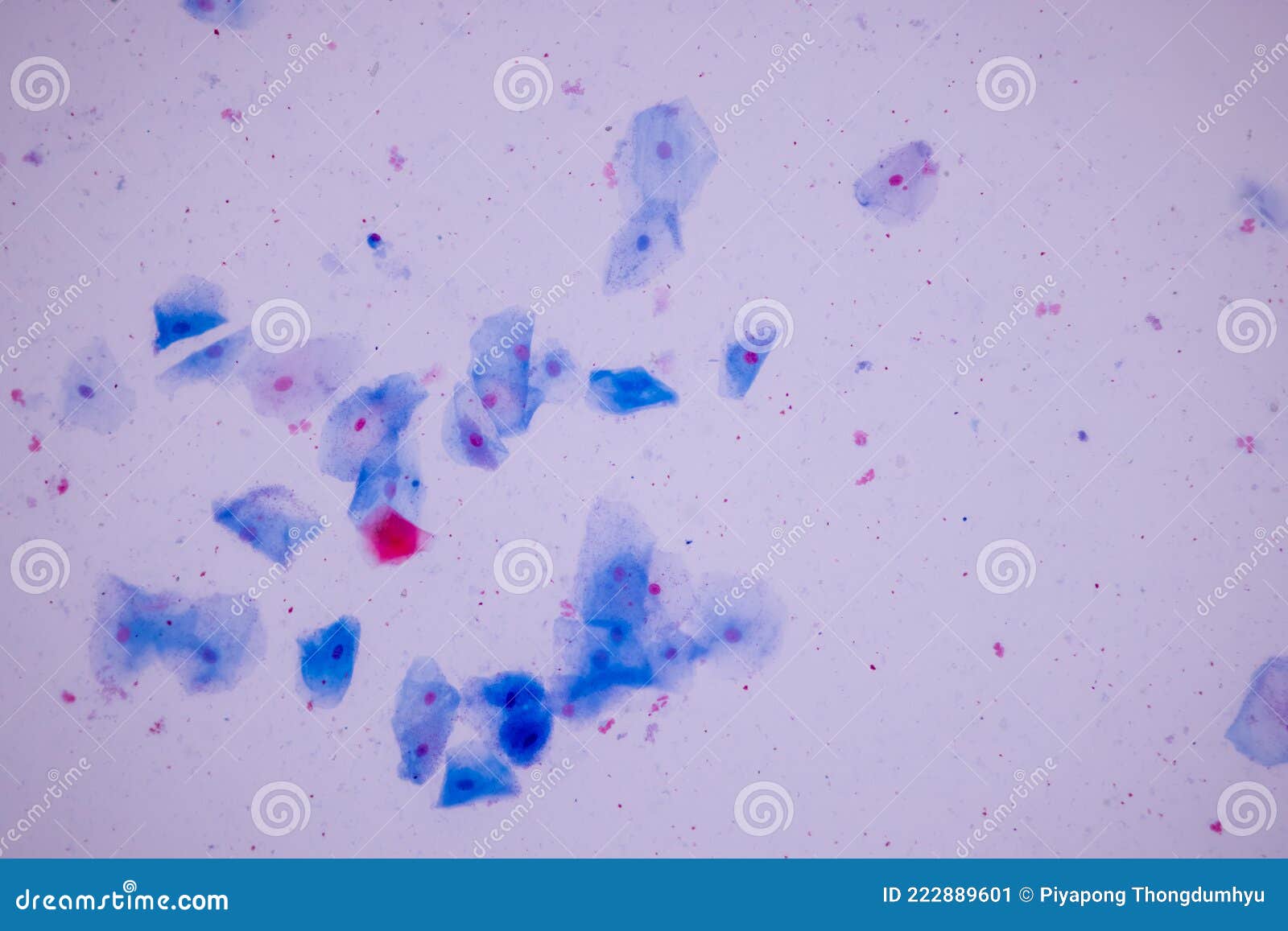 Histological Sample Squamous Epithelial Cells Under Microscope. Stock ...