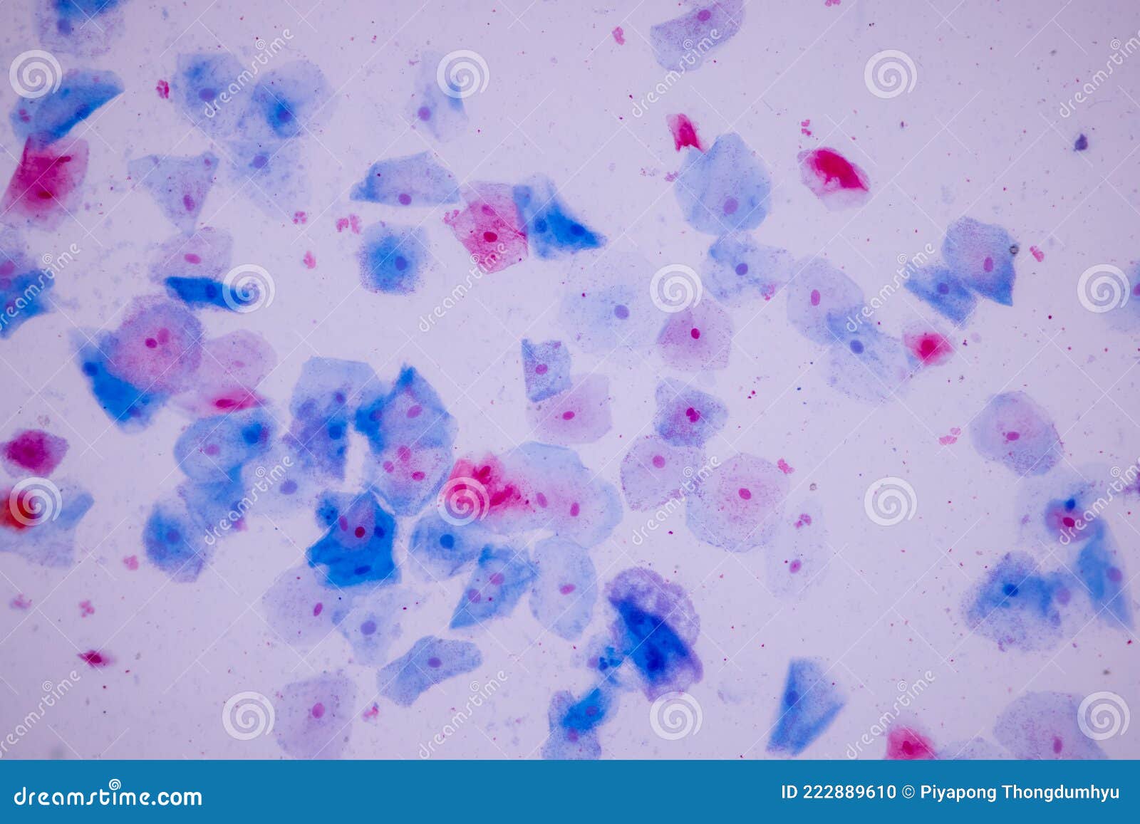 Human Epithelial Cells Under Microscope