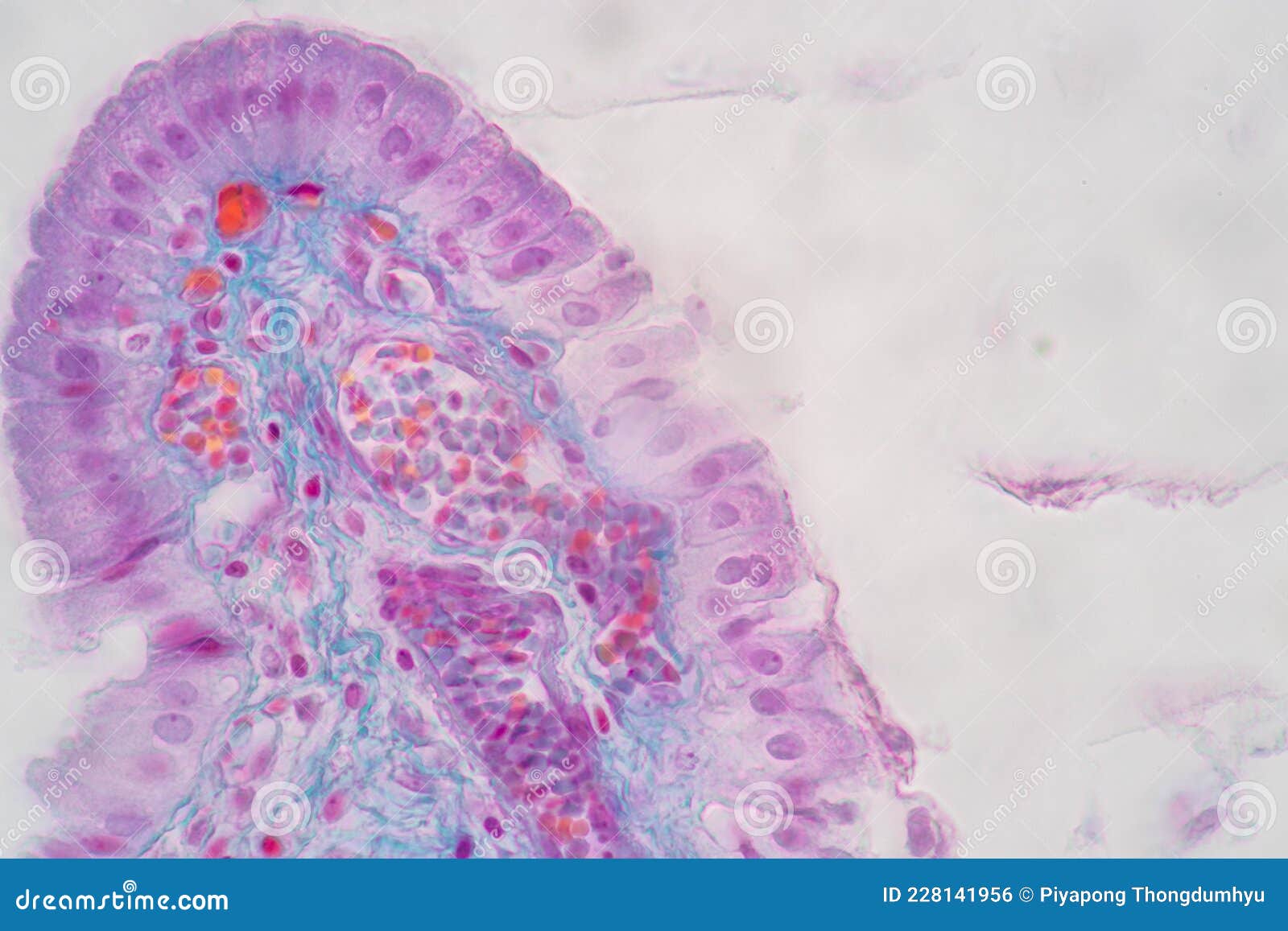 Characteristics of Columnar Epithellum Cell Cell Structure of Human ...