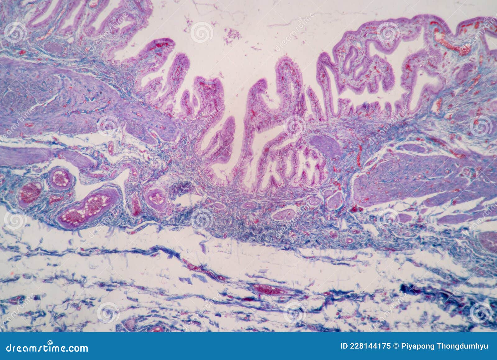 Characteristics of Columnar Epithellum Cell Cell Structure of Human ...