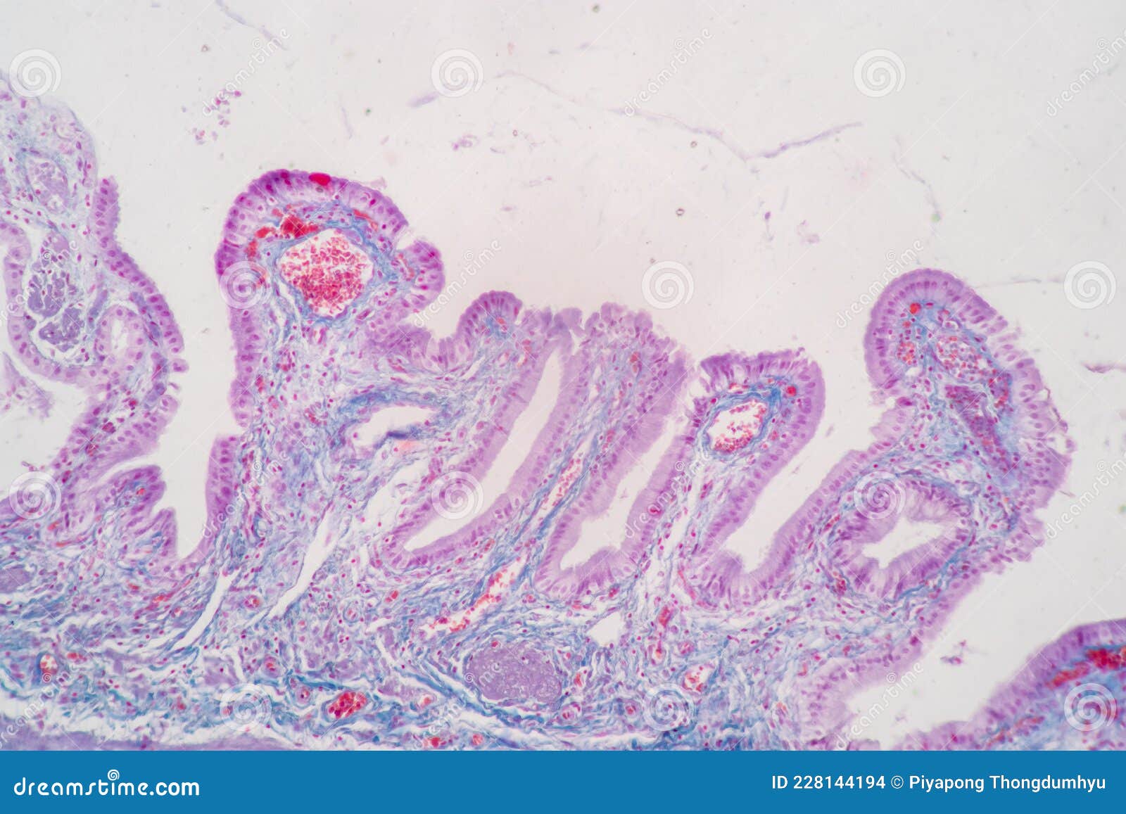 Characteristics of Columnar Epithellum Cell Cell Structure of Human ...