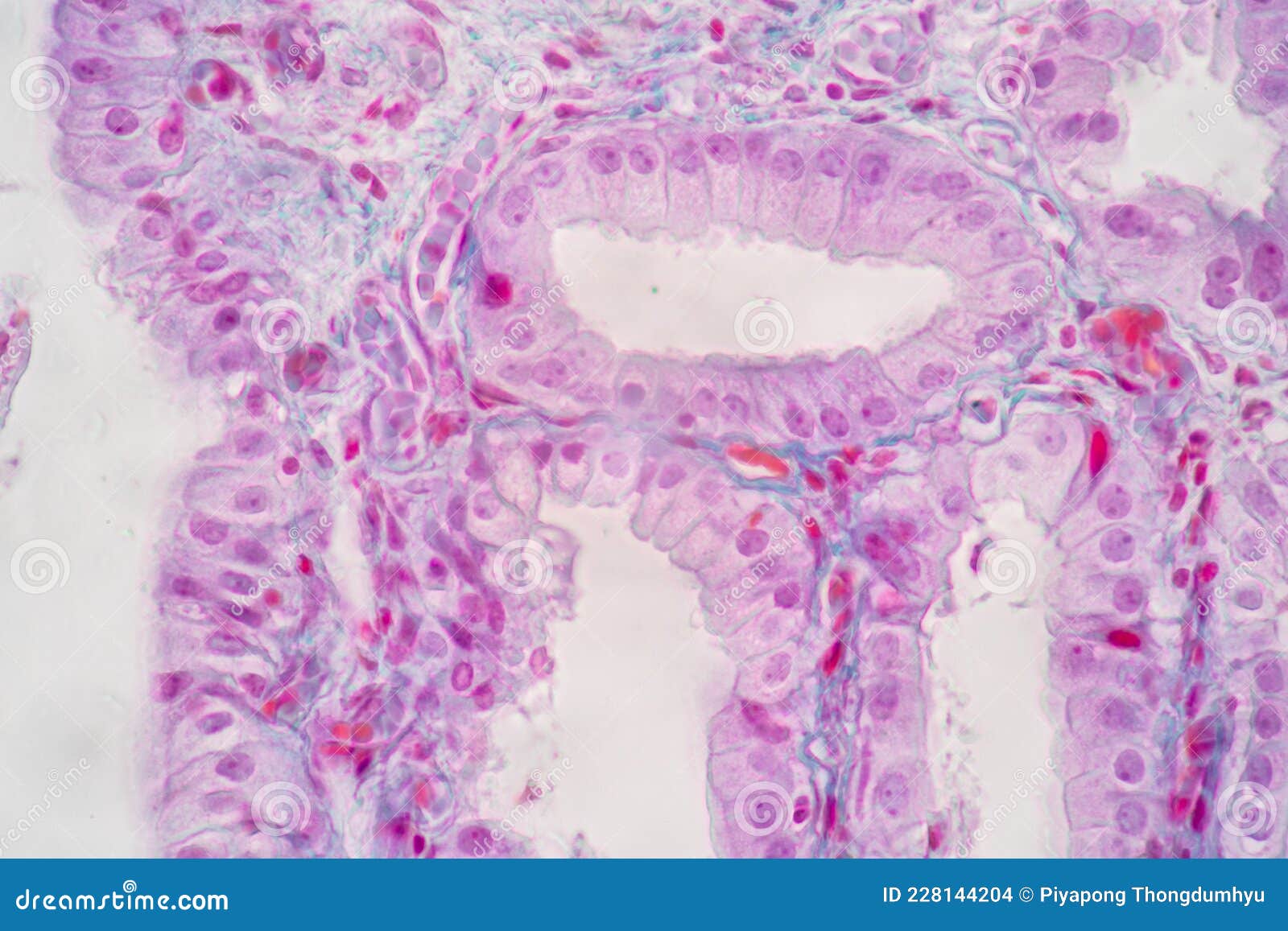 Characteristics of Columnar Epithellum Cell Cell Structure of Human ...
