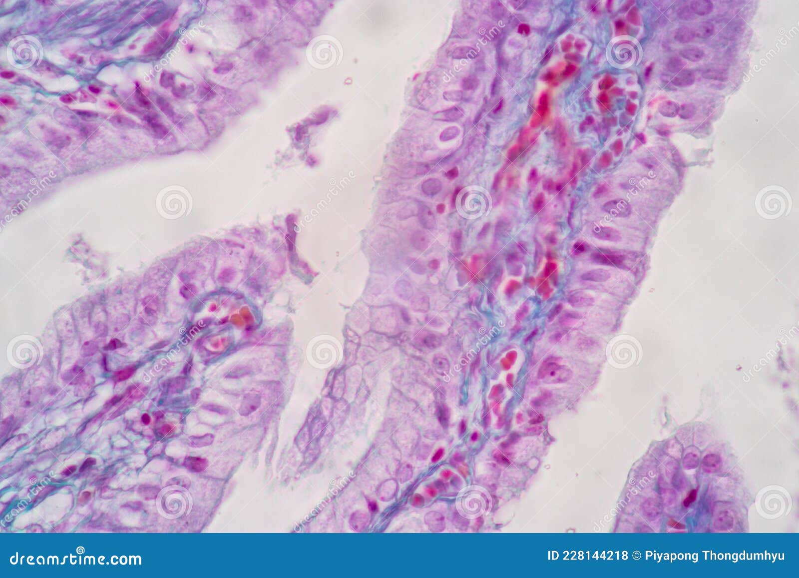 Characteristics of Columnar Epithellum Cell Cell Structure of Human ...