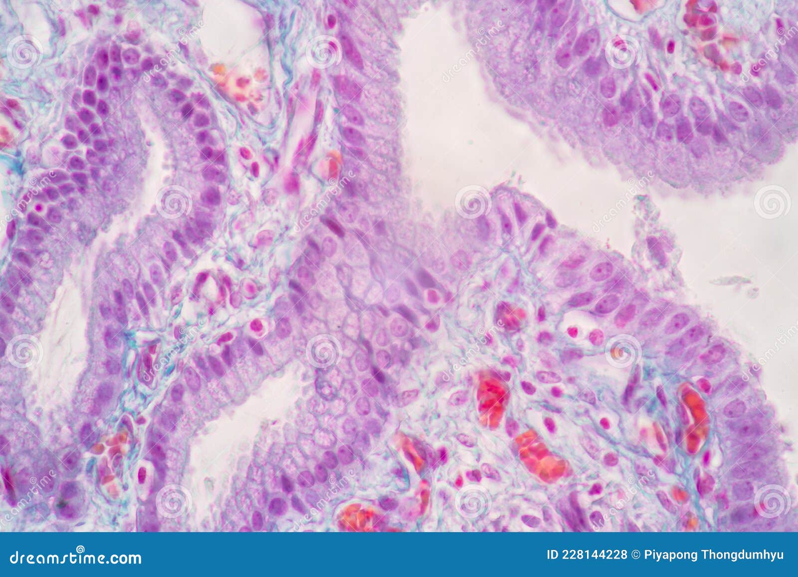 Characteristics of Columnar Epithellum Cell Cell Structure of Human ...