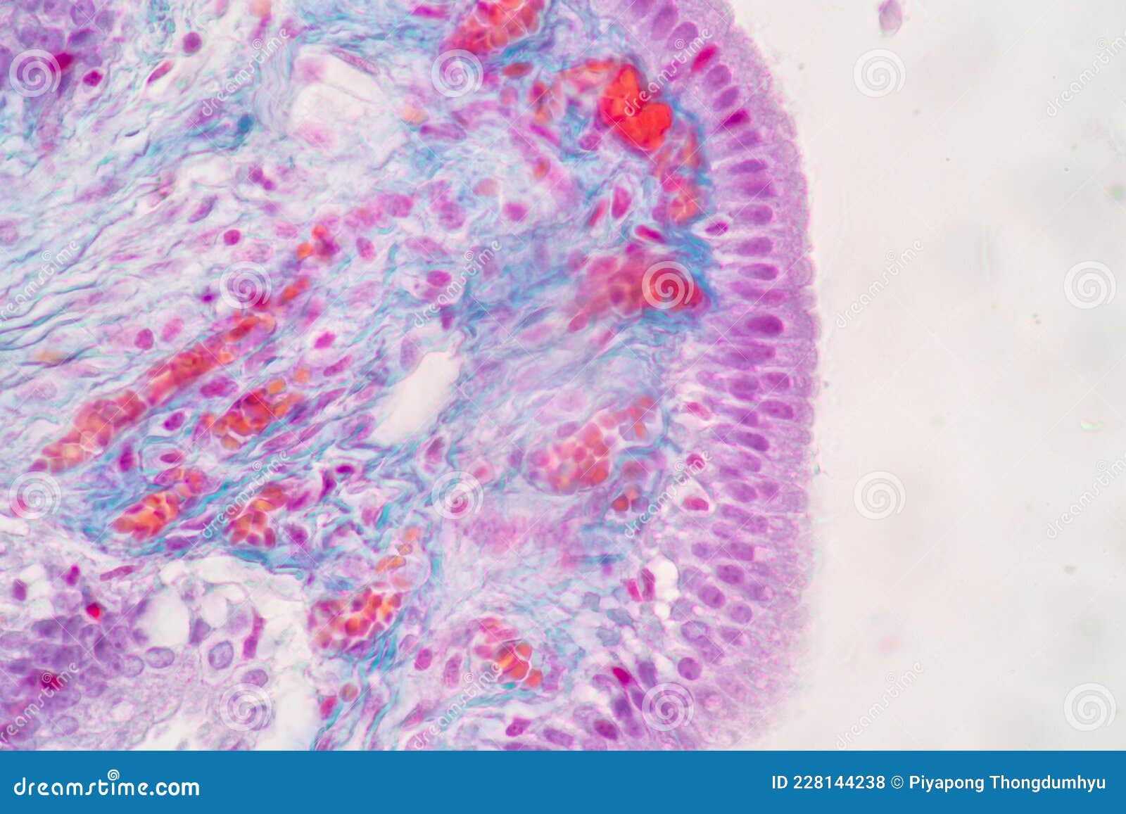 Characteristics of Columnar Epithellum Cell Cell Structure of Human ...