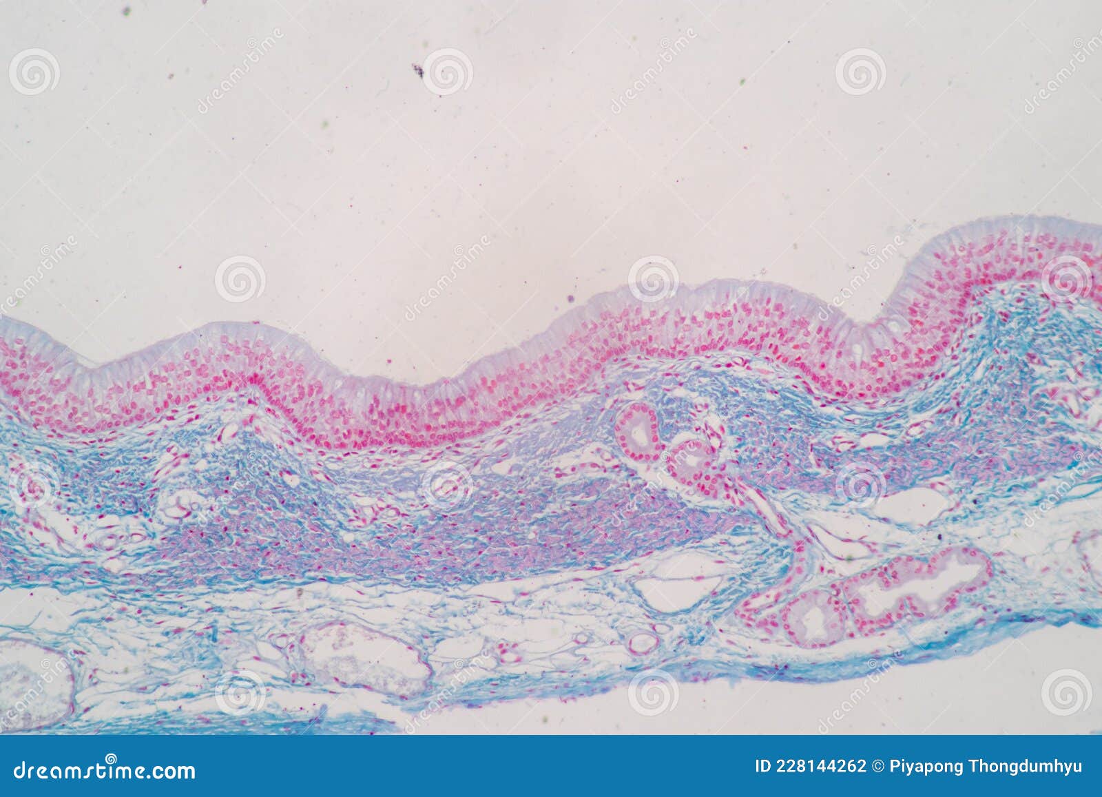 Characteristics of Columnar Epithellum Cell Cell Structure of Human ...