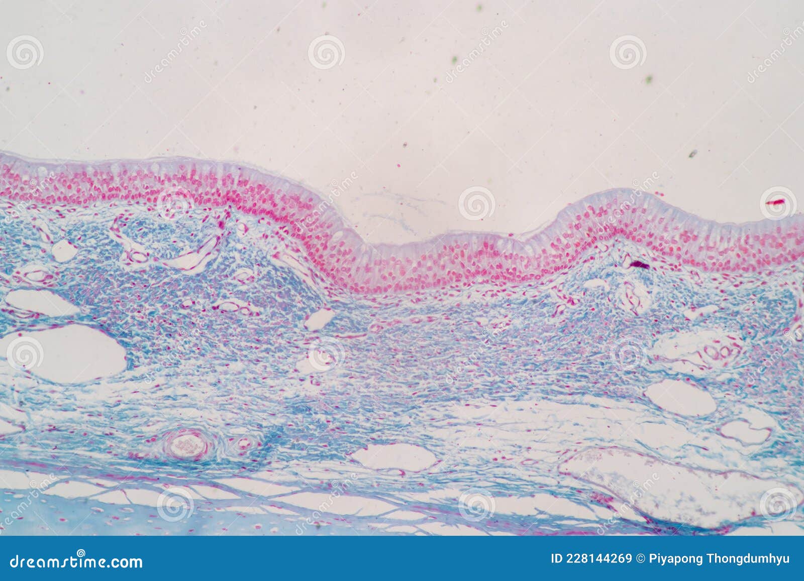Characteristics of Columnar Epithellum Cell Cell Structure of Human ...