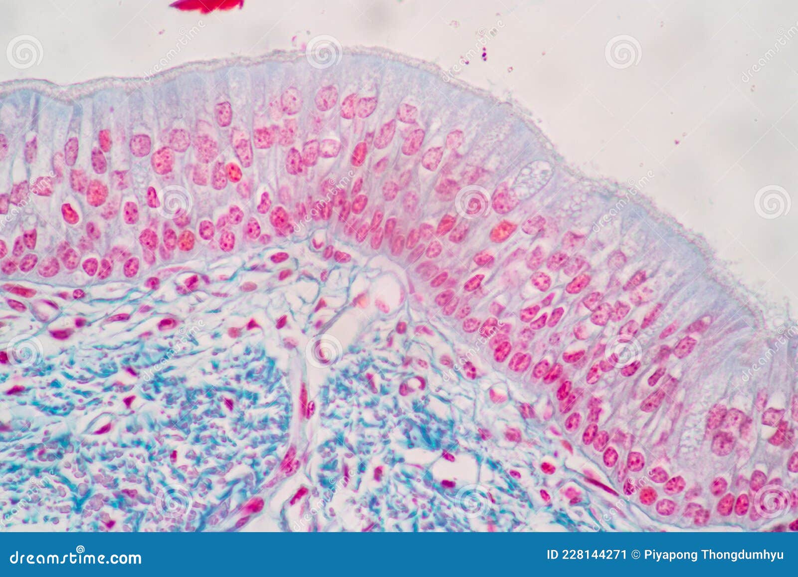 Characteristics of Columnar Epithellum Cell Cell Structure of Human ...