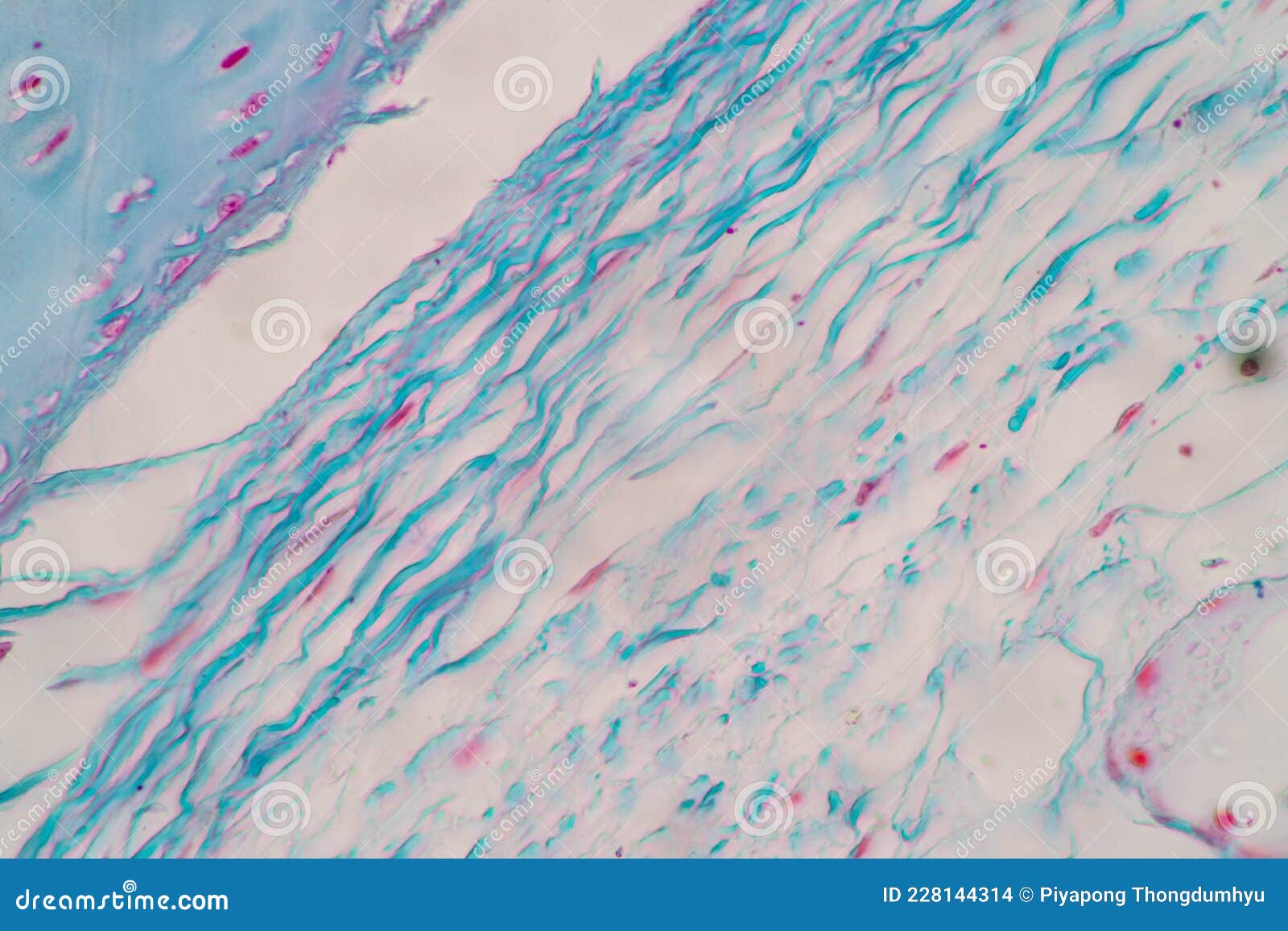 Characteristics of Columnar Epithellum Cell Cell Structure of Human ...