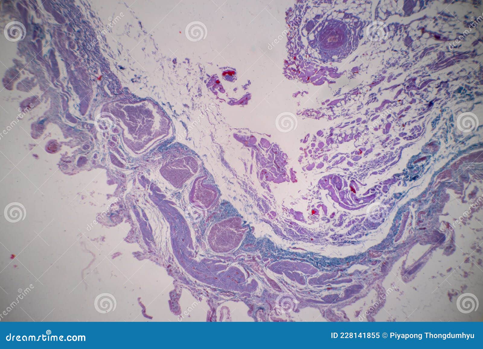 Characteristics of Columnar Epithellum Cell Cell Structure of Human ...