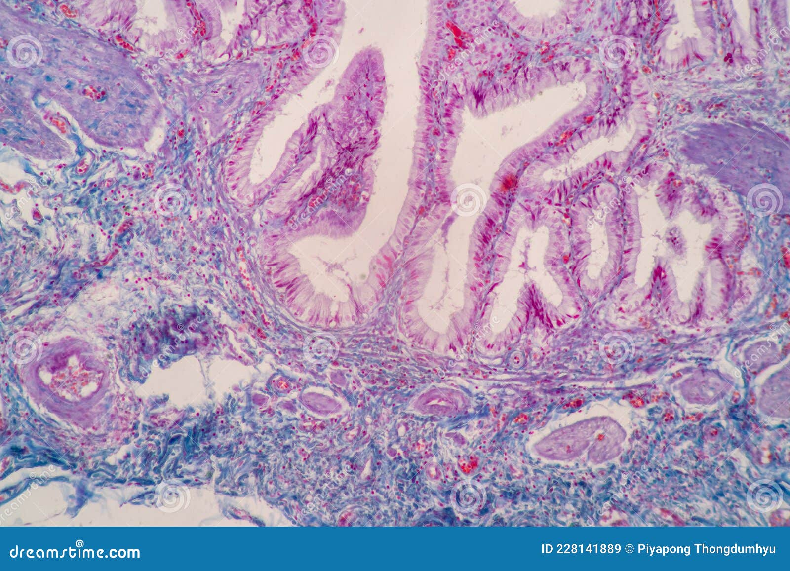 Characteristics of Columnar Epithellum Cell Cell Structure of Human ...