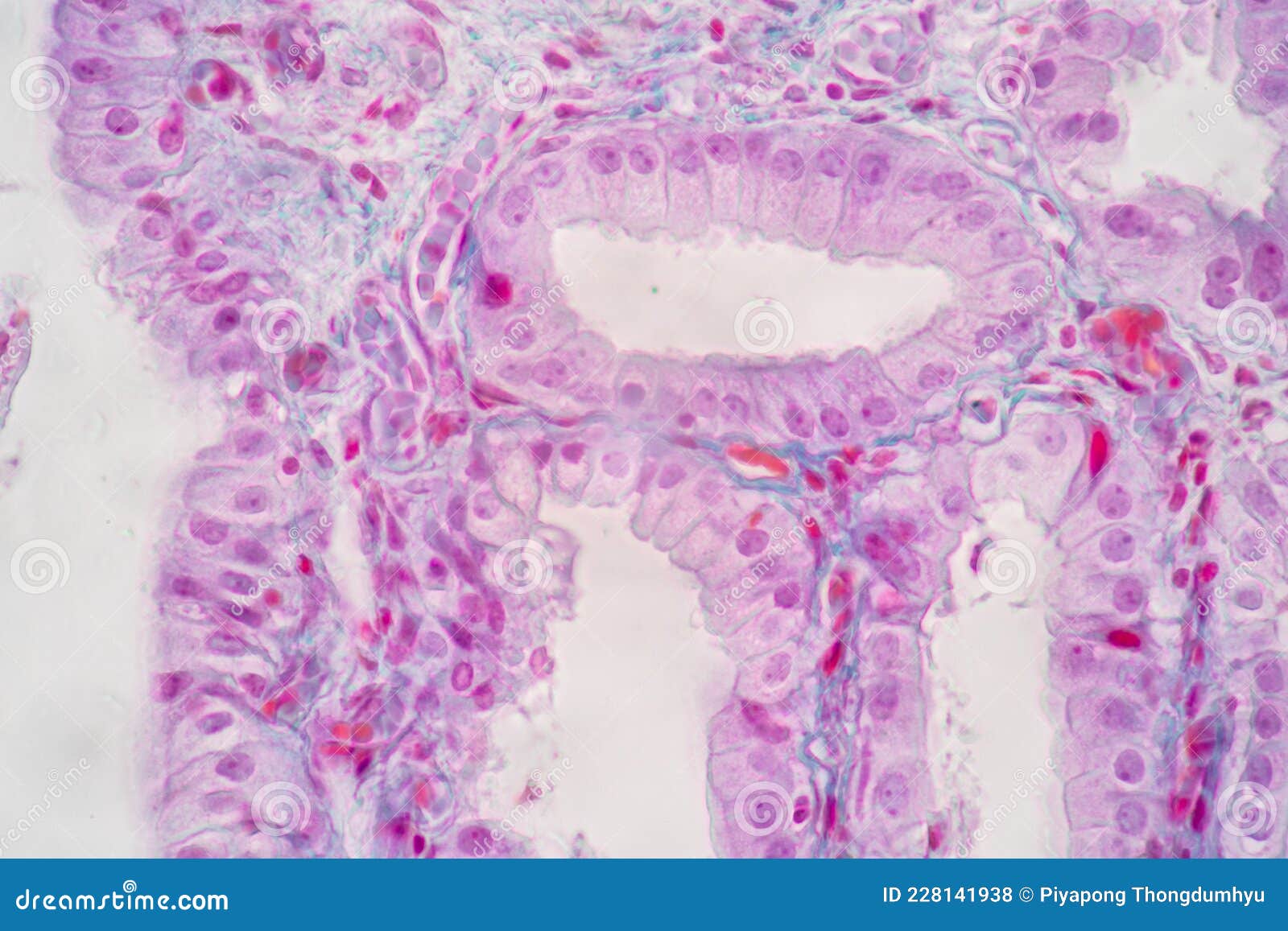 Characteristics of Columnar Epithellum Cell Cell Structure of Human ...