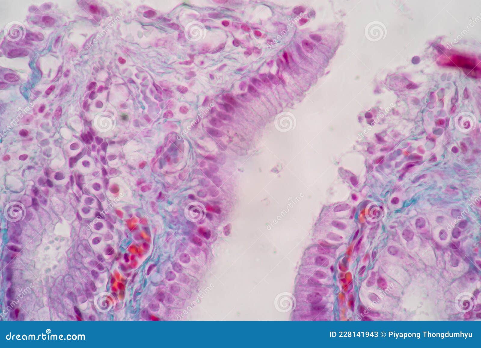 Characteristics of Columnar Epithellum Cell Cell Structure of Human ...