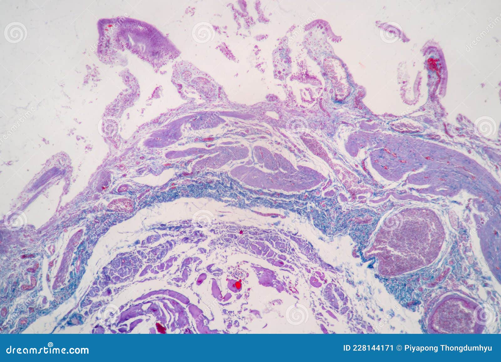 Characteristics of Columnar Epithellum Cell Cell Structure of Human ...
