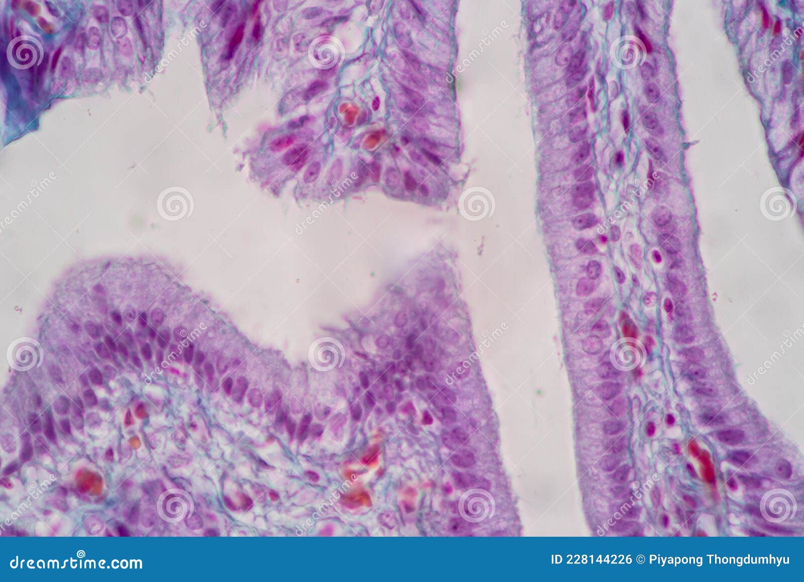 Characteristics of Columnar Epithellum Cell Cell Structure of Human ...