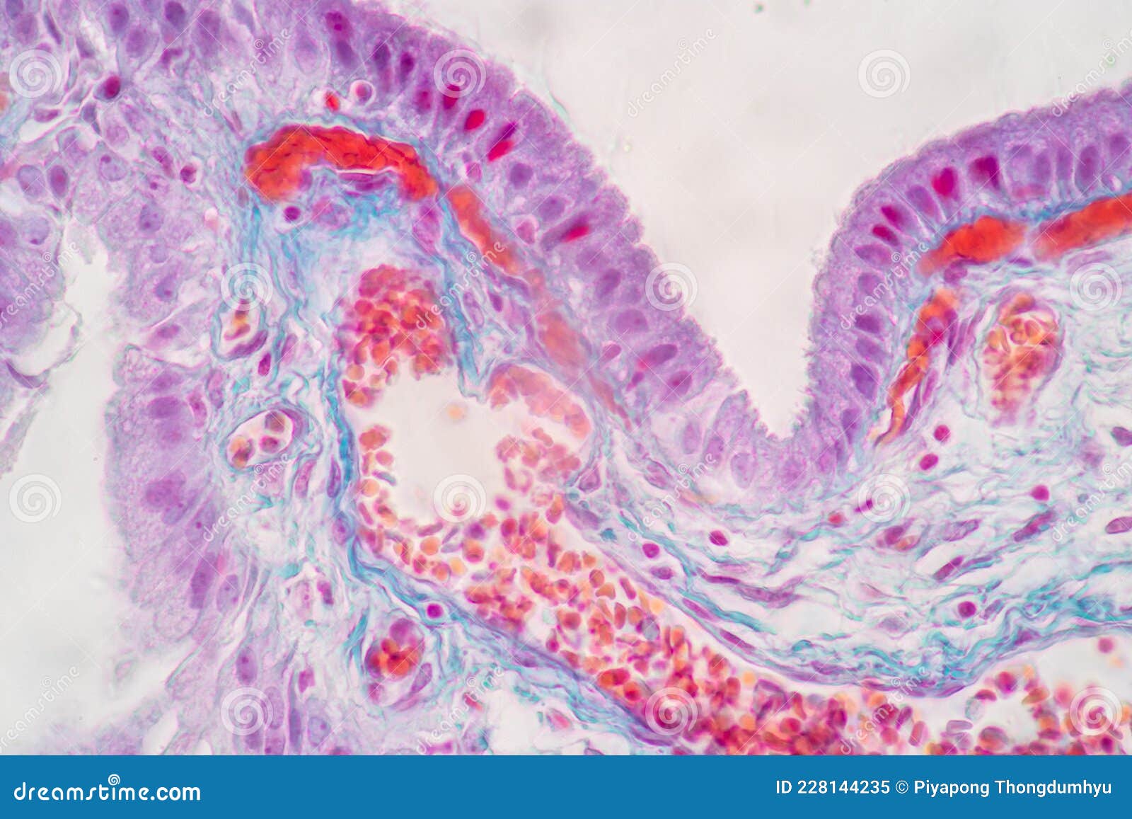 Characteristics of Columnar Epithellum Cell Cell Structure of Human ...