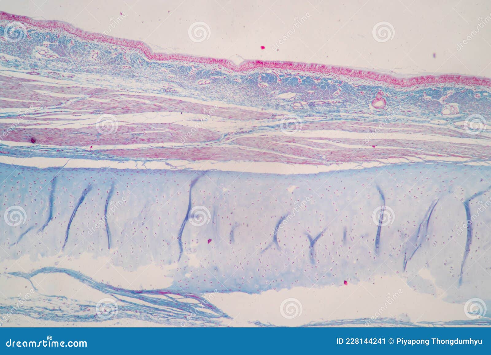Characteristics of Columnar Epithellum Cell Cell Structure of Human ...