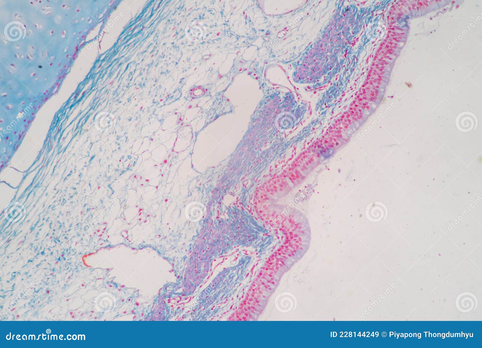Characteristics of Columnar Epithellum Cell Cell Structure of Human ...