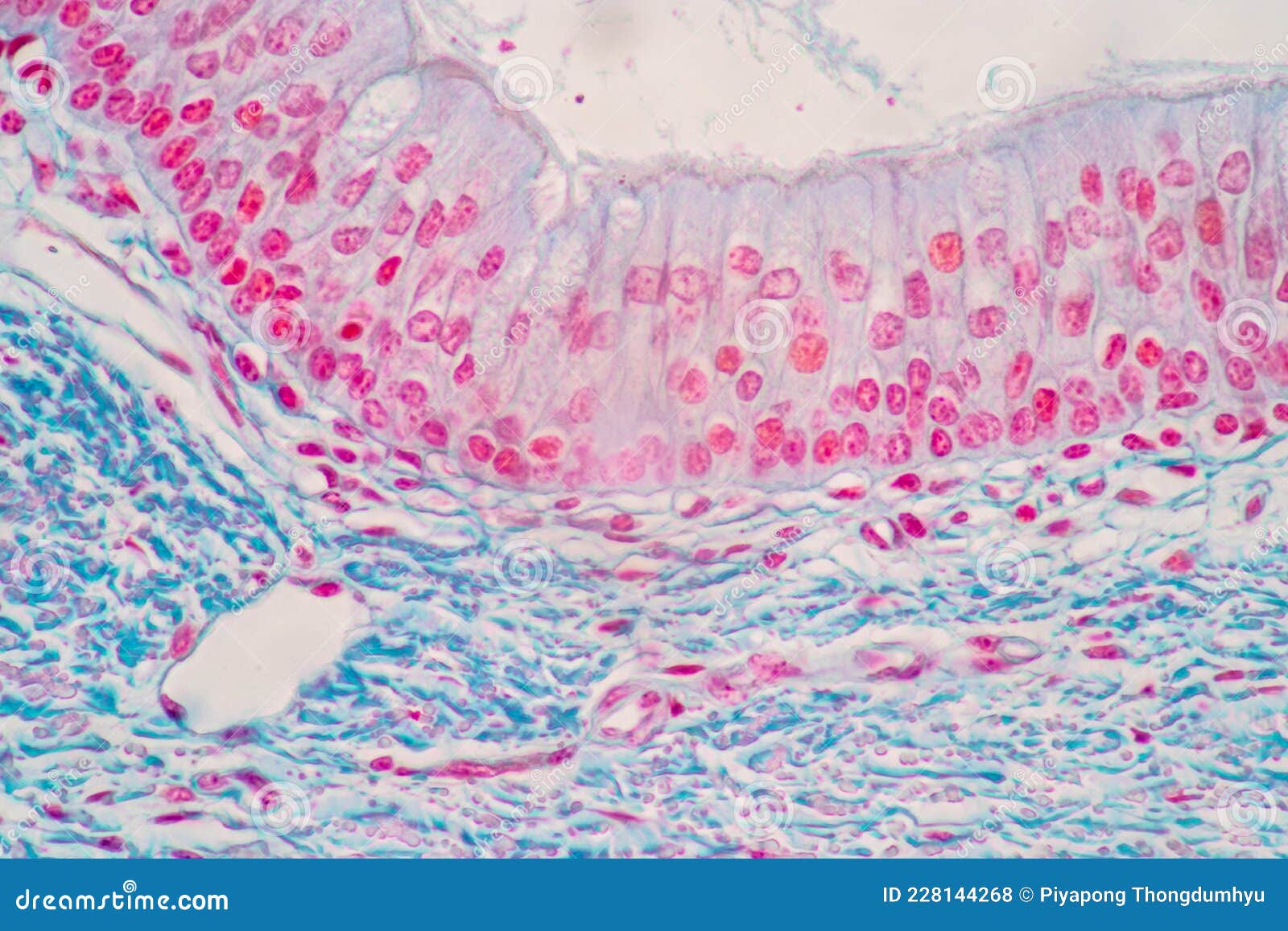 Characteristics of Columnar Epithellum Cell Cell Structure of Human ...