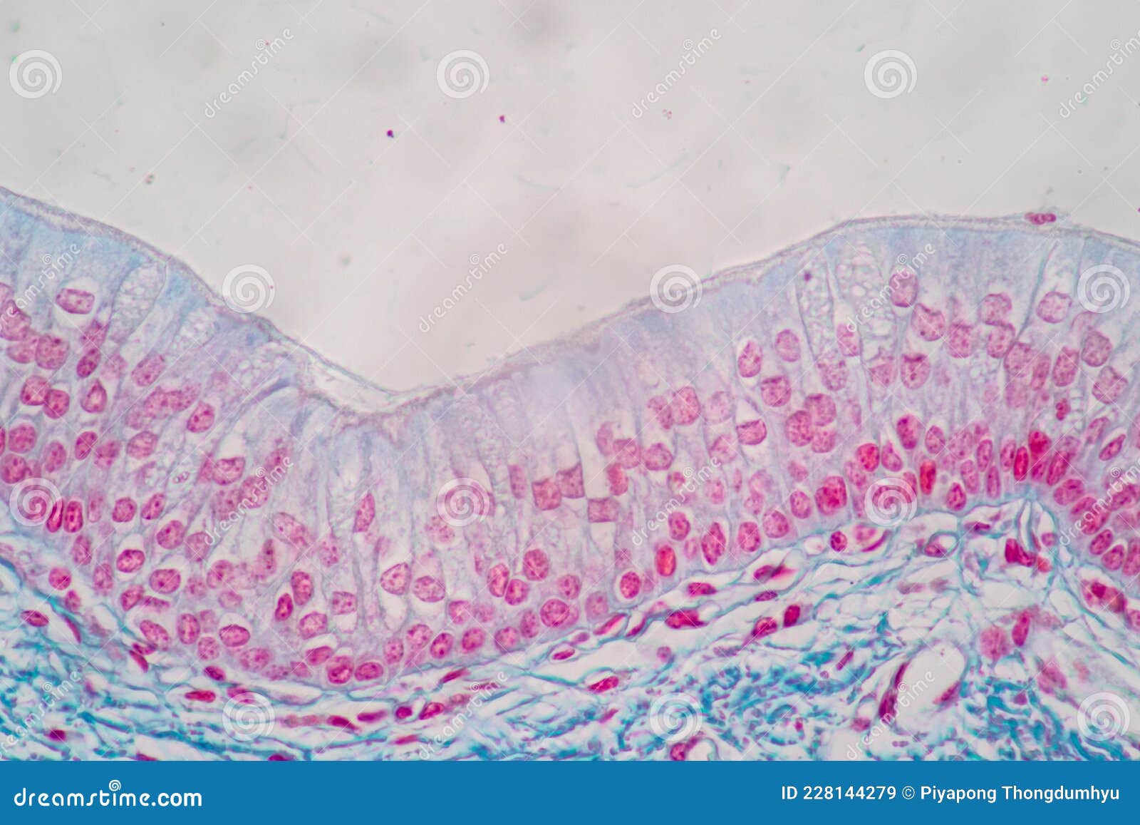 Characteristics of Columnar Epithellum Cell Cell Structure of Human ...