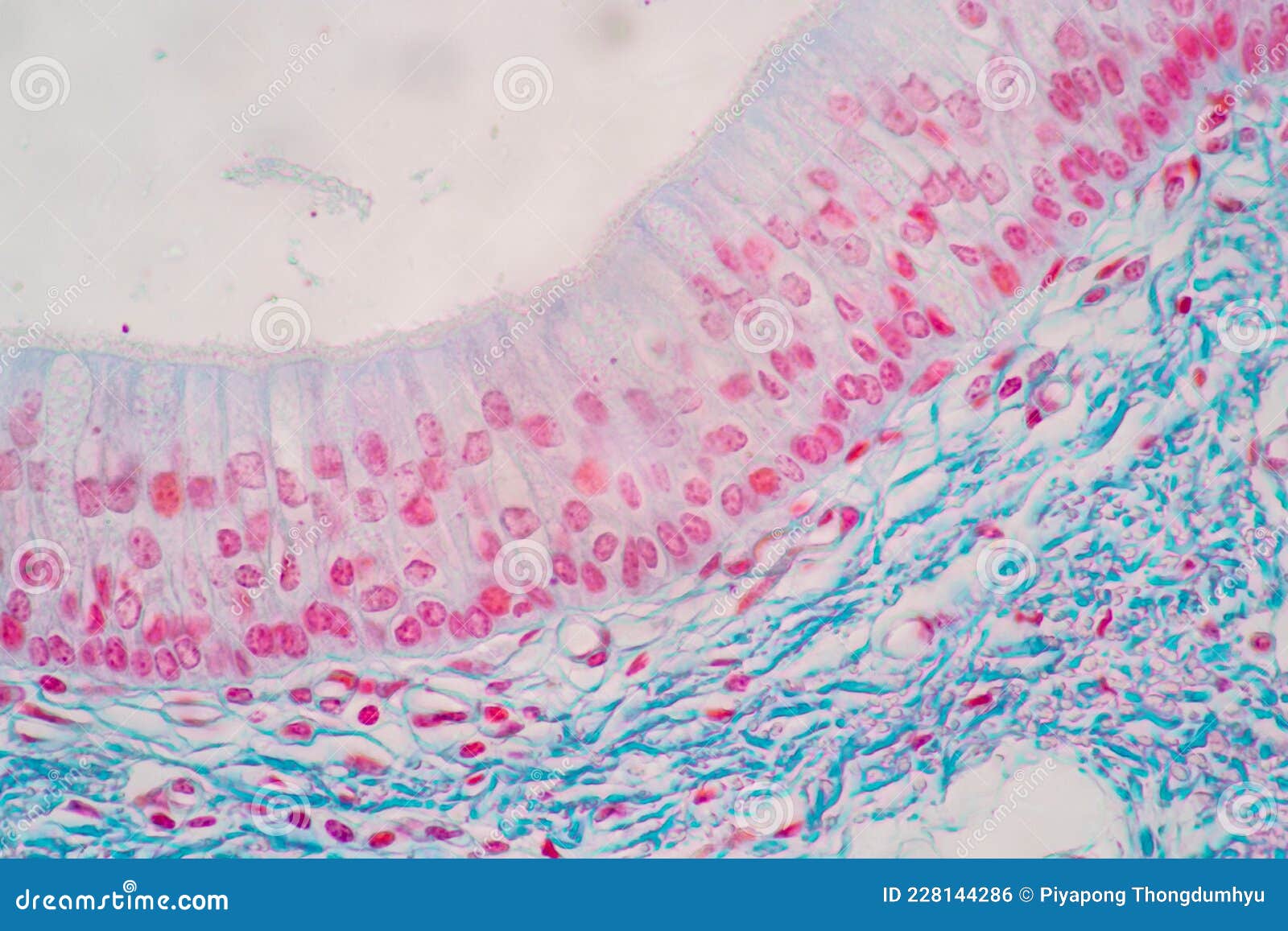 Characteristics of Columnar Epithellum Cell Cell Structure of Human ...