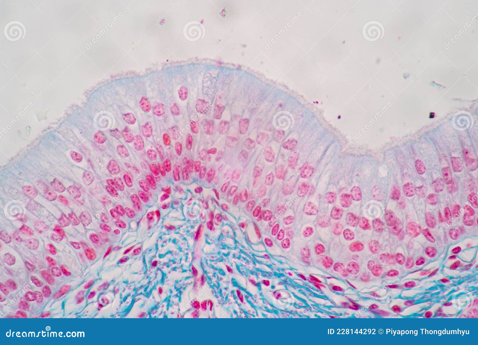 Characteristics of Columnar Epithellum Cell Cell Structure of Human ...