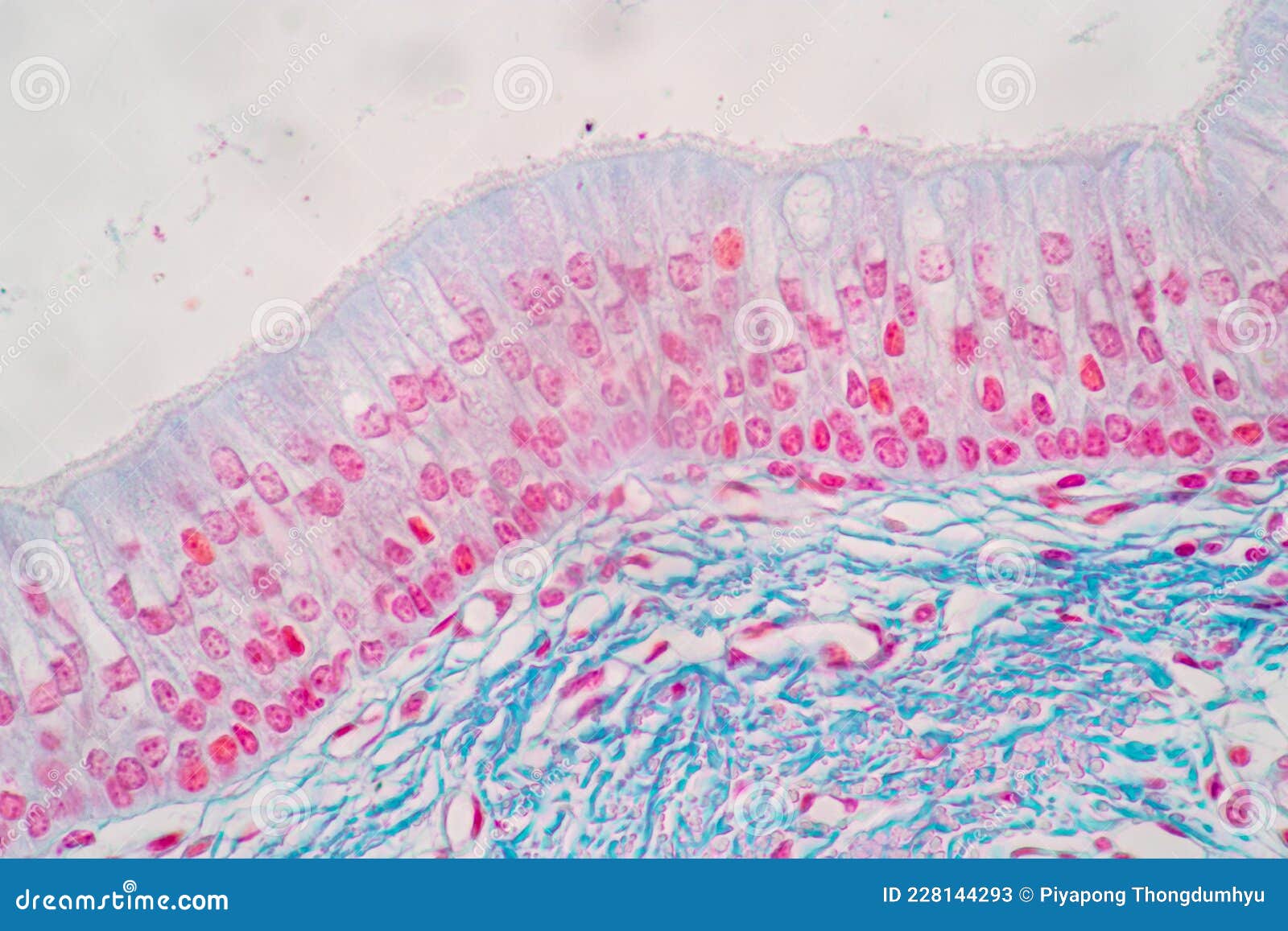 Characteristics of Columnar Epithellum Cell Cell Structure of Human ...