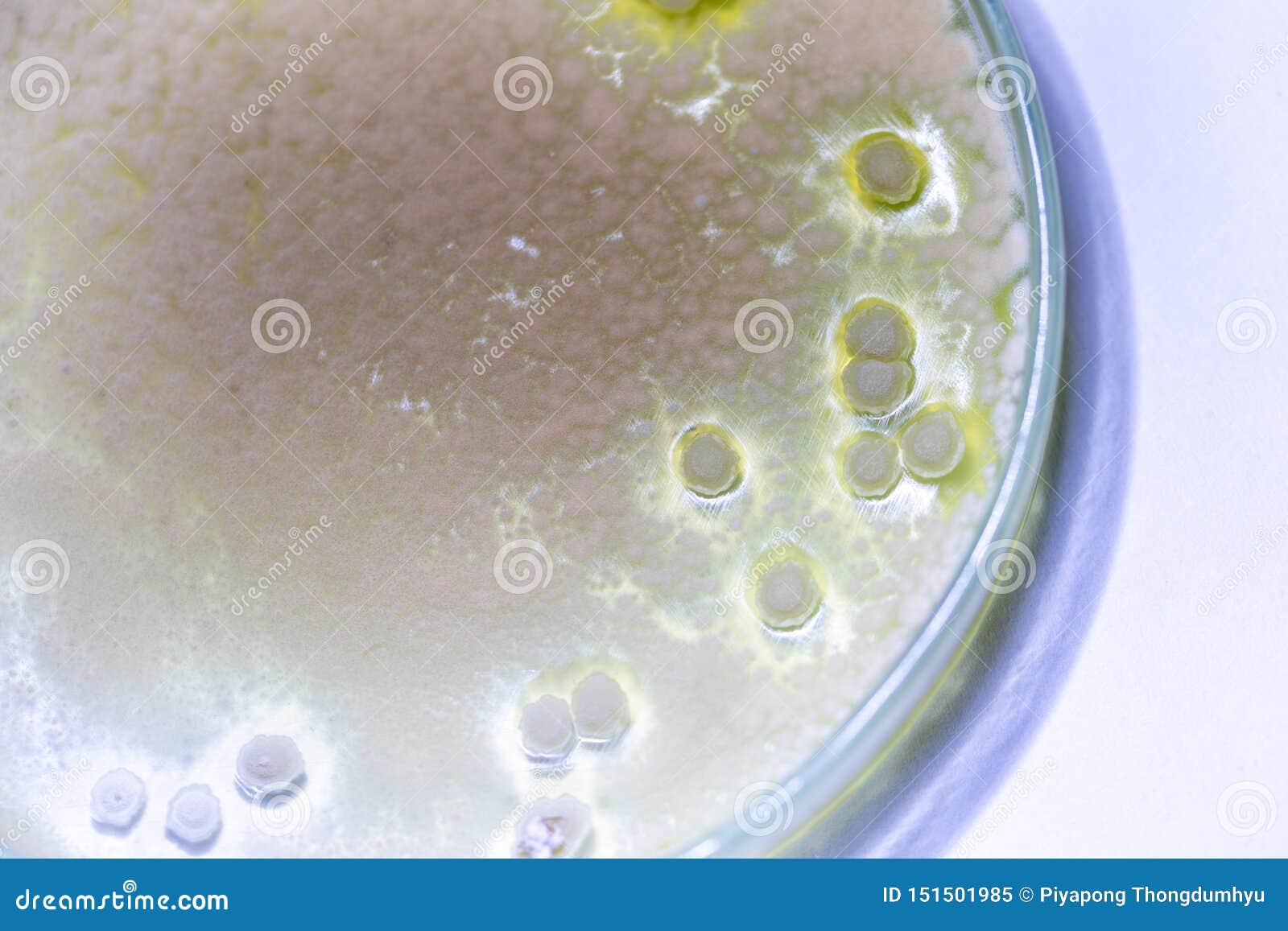 Characteristics and Different Shaped Colony of Bacteria and Mold ...