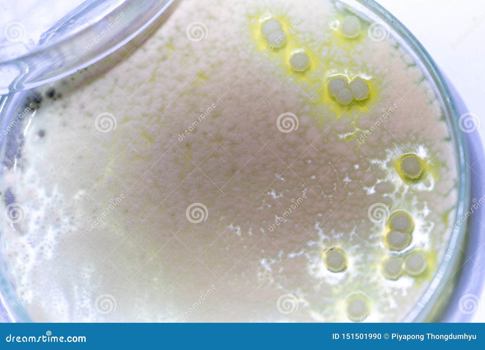 Characteristics and Different Shaped Colony of Bacteria and Mold ...